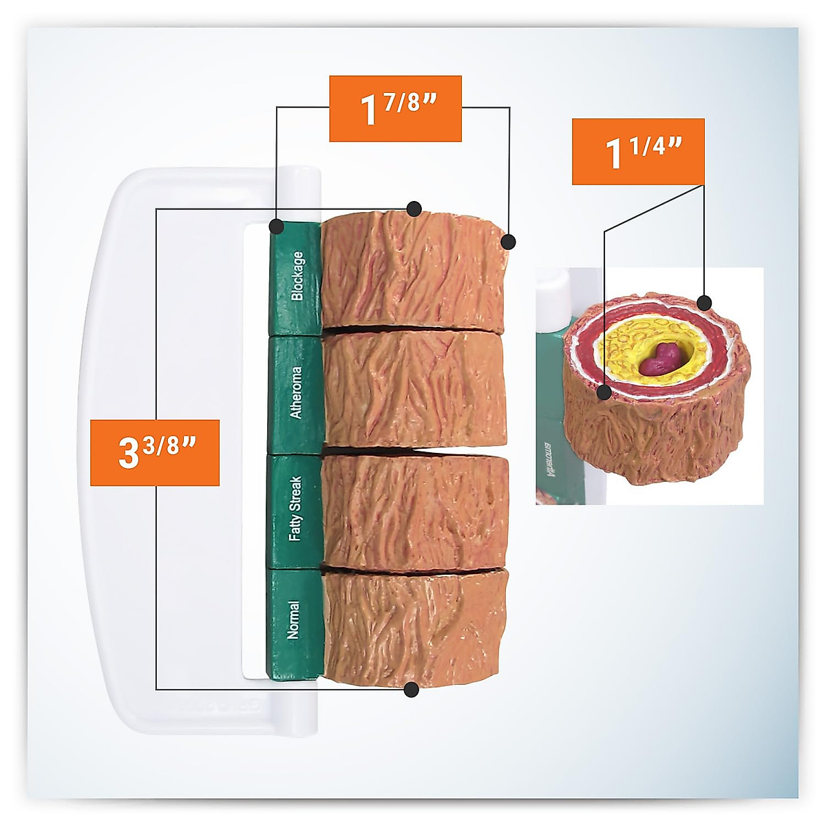 4-Piece Artery Model | Human Body Anatomy Replica of Artery w/Plaque Build Up for Doctors Office Educational Tool | GPI Anatomicals
