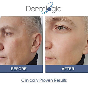 Dark Spot Corrector Cream- Visibly Fades & Repairs Marks from Dark Spots, Sunspots, Age Spots, Acne Scars, Brown Spots & Freckles for Face & Body. Safe for All Skin Types. 