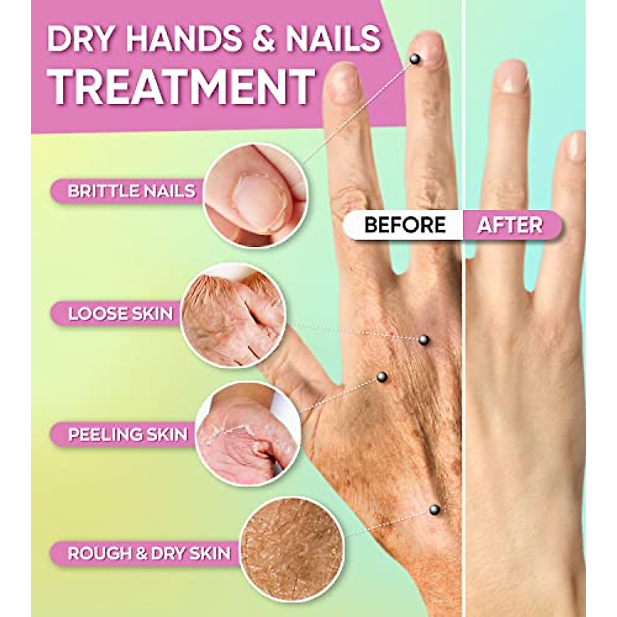 Moisturizing Hand Mask for Dry Cracked Hands & Nails - Hydrating Spa Treatment - Korean Collagen Gloves with Natural Plant Extracts - Nourishing Skin Care Gift with Shea Butter for Women & Men by Elixir