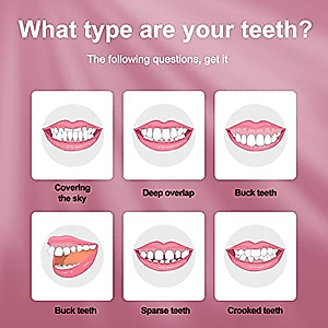 Fake Teeth, 2 PCS Veneers Dentures Socket for Women and Men, Dental Veneers for Temporary Tooth Repair Upper and Lower Jaw, Protect Your Teeth and Regain Confident Smile, Bright White-AA08
