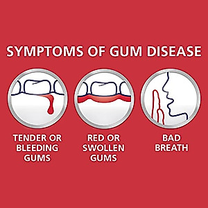 Parodontax Complete Protection Whitening Toothpaste To Help Prevent Bleeding Gums, Anticavity, Gum Toothpaste For Gum Health And Whitening - 3.4 oz x 3