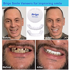 Brige Smile Teeth Denture Temporary False Teeth Improve Smile