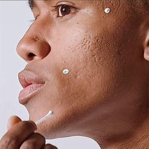 Malin + Goetz Acne Treatment Nighttime, 0.5 Fl. Oz. - Overnight Sulfur Acne Spot Treatment, Blemish Control & Scar Treatment, All Skin Types, Vegan & Cruelty Free