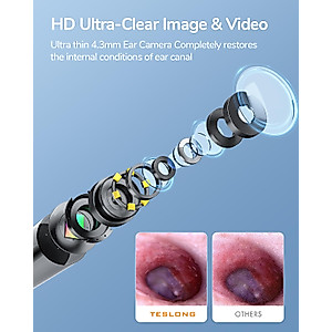 Teslong Otoscope, Video Otoscope with Light, Digital Otoscope with Ear Wax Removal Tools, Ear Camera for Android Phone, USB, with Ear Picks