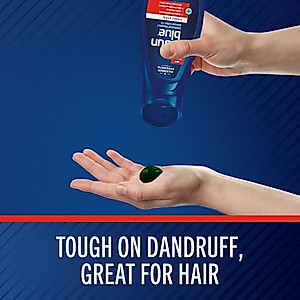 Selsun Blue Medicated Antidandruff Shampoo, Maximum Strength Scalp Treatment With Selenium Sulfide, 11 fl. oz.