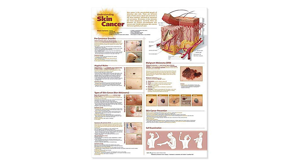 Understanding Skin Cancer Anatomical Chart | Medical Education Tool