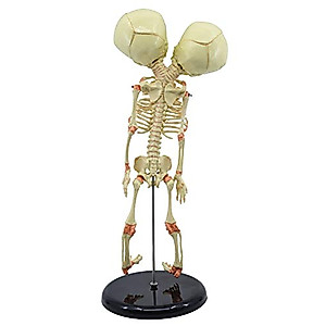 Infant Fetus Skeleton Model, Mini Size - Twin, Conjoined Skull - Rod Mounted - Incredible Detail for Anatomical Study - Eisco Labs