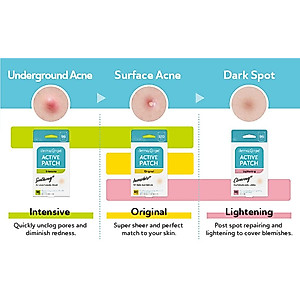 DERMA ANGEL Ultra Invisible Dark Spot Patches for Post Acne Pimple, Acne Spot Treatment - Day and Night Use - UPGRADED (Post Acne - 96 Count - 1 Size)