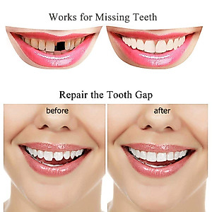 Tooth Repair Kit-Thermal Beads for Filling Fix The Missing and Broken Tooth or Adhesive The Denture Fake Teeth