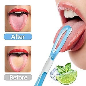Denovin 6 Pack Tongue Scrapers for Adults, Tongue Cleaner for Oral Care, Tongue Scrubber Helps Reduce Bad Breath and Fresh Breath, Easy to Carry and Use (Pink and Blue)