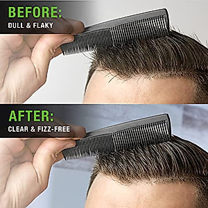 Viking Revolution Tea Tree Shampoo and Conditioner Set - Hydrates, Moisturizes & Soothes Dry and Itchy Scalps - With Natural Tea Tree Oil - 17 oz