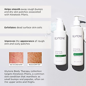 Glytone KP Kit for Keratosis Pilaris - Exfoliating Body Wash, Lotion, Shower Pouf - Smooth Rough & Bumpy Chicken Skin - Fragrance-Free, Routine Kit