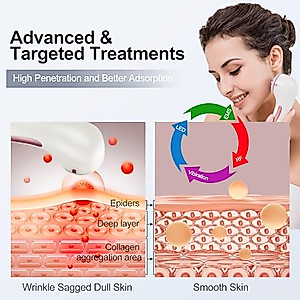 MiSMON High Frequency Facial Machine LED Light Theraphy Skin Tightening Device for Face, 5 in 1 Multifunctional Facial Massager for Wrinkle and Acne Removal