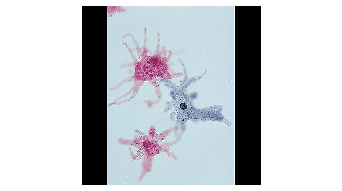 Amoeba Proteus Microscope Slide for Biology Students & Educators