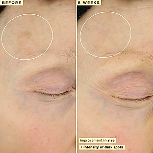 Farmacy 10% Vitamin C Face Serum - Waterless Vitamin C Skin Care Serum to Brighten, Firm + Smooth Skin Texture - Enriched with Upcycled Tangerine Peel to Boost Skin's Moisture + Radiance (30ml)