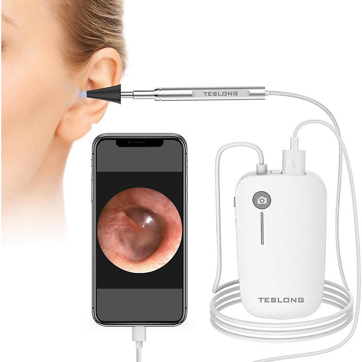 Teslong Otoscope Accessories: 9 Disposable Speculums, 4 Ear Picks, 1 Pack of Q-Tips, Accessories for NTE100i Ear Camera Ear Scope, 0.16 inch or 4.3mm Dia.