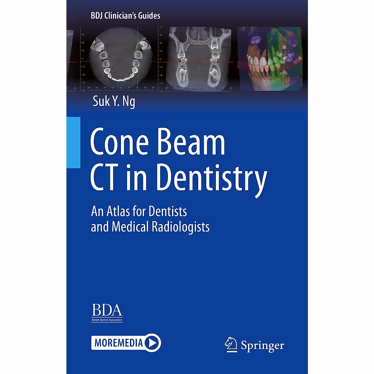Cone Beam CT in Dentistry: An Atlas for Dentists and Medical Radiologists (BDJ Clinician’s Guides)