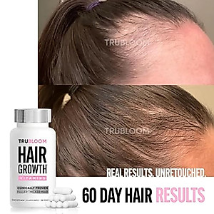 Tru Bloom Hair Growth Vitamins - 1 Month Supply. Clinically Proven for Fuller, Thicker Hair. Natural & Drug-Free. Ultimate Hair Vitamins for Proven Results