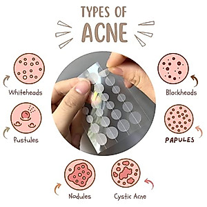 Perfect Pamper Acne Patches - Medical Grade Hydrocolloid Pimple Patch, Covers Pimples, Zits, and Blemishes. Heals Acne, Reduces Inflammation and Redness for Beautiful, Clear Skin. 48 Patches in Resealable Pouch. Cruelty Free