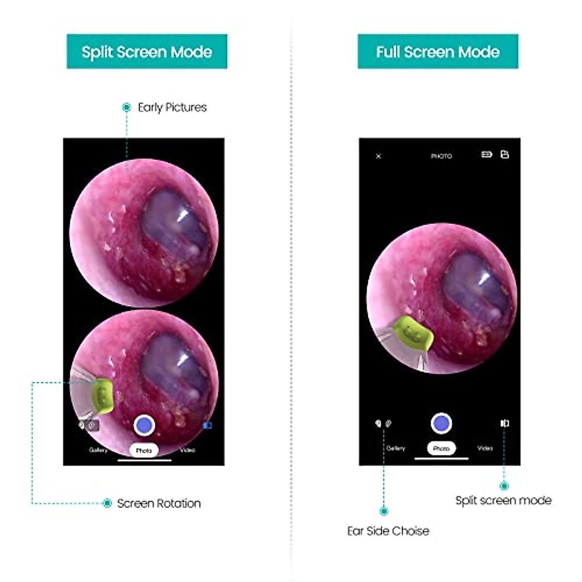 Wireless Otoscope Ear Camera with Dual View, 3.9mm 720PHD WiFi Ear Scope with 6 LED Lights for Kids and Adults, Compatible with Android and iPhone