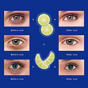 Gel Ice Pack Reusable Cooling Eye Pads and Under Patches,Eye Hot Cold Treatment for Redness,Pain Relief Relax