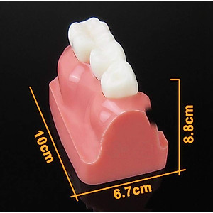 Analysis Model for Dental Implant Crown Bridge Demonstration Teeth Model for Education M2017