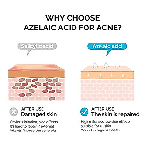 ZealSea Face Sheet Mask, 5 Pack Anti-Acne Face Mask, Face Mask Skin Care for Sensitive Soothing, Pore Cleansing, Moisturizing, Brightening, Firming, Beauty Mask for All Skin Type