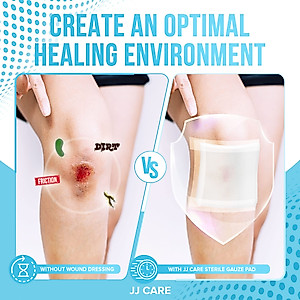 JJ CARE Sterile Gauze Pads 4" x 4" (Pack of 100), 12-Ply Cotton Gauze Pads, Individually-Wrapped Sterile Gauze Sponges, 100% Woven, Non-Stick Medical Gauze Pads for First Aid Kit & Wound Care