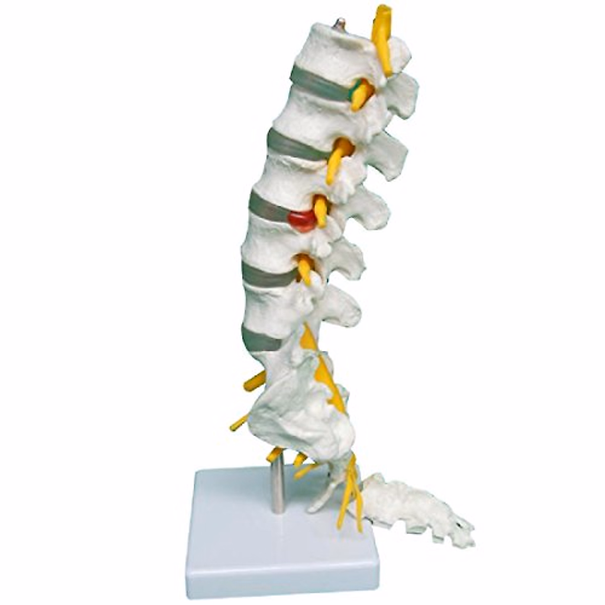 tinsay Anatomical Human Spine Model Consists of 5 Lumbar Vertebrae with Intervertebral Discs,Lumbar Nerves and Spinal Cord.