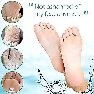 I PEEL GOOD! This 4-pair foot mask provides an at-home pampering spa experience to intensely moisturize, repair and soften rough and dry feet. The foot mask penetrates deeply to heal and hydrate dry cracked skin, restoring your skin's natural moisture bal
