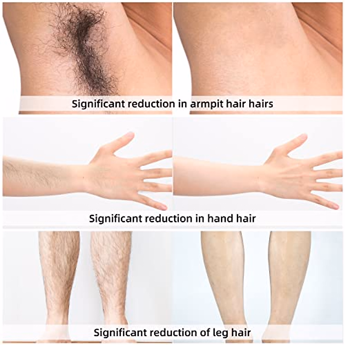 Roll on Waxing Kit for Hair Removal, Roll Waxing Kit for Women Men, Wax Heater with 2 Wax Roller Cartridge Refill for Legs Arms and Underarm(Wax Heater 1, Wax Paper 100, Pre&After Wax Oil)