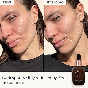 Tru Alchemy Vitamin C Glow Serum | Facial Serum with Bakuchiol, Glycolic & Lactic Acid | Skin Illuminating Serum | Anti-aging Vitamin C Face Serum | Hydrating Face Wrinkle Serum | 1 fl oz/30 ml