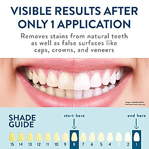 LOVE YOUR TEETH Whitening Device Kit - Teeth Whitening System with LED Blue Light Mouthpiece - Home Teeth Whitener - Clinically Tested Whitening Kit for Stained Teeth - 7 Shades Whiter Teeth in 7 Days