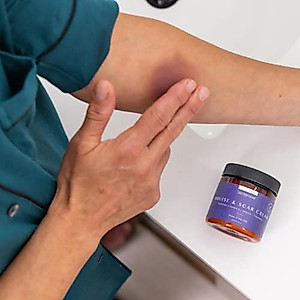 SKINTENSIVE Highest Purity Organic Arnica Plant-Based Bruise Cream for Thin Skin - Moisturizing, Anti-Aging, Healing, and Fading Scar Lotion, Vitamin K C and E, Skin Renewal