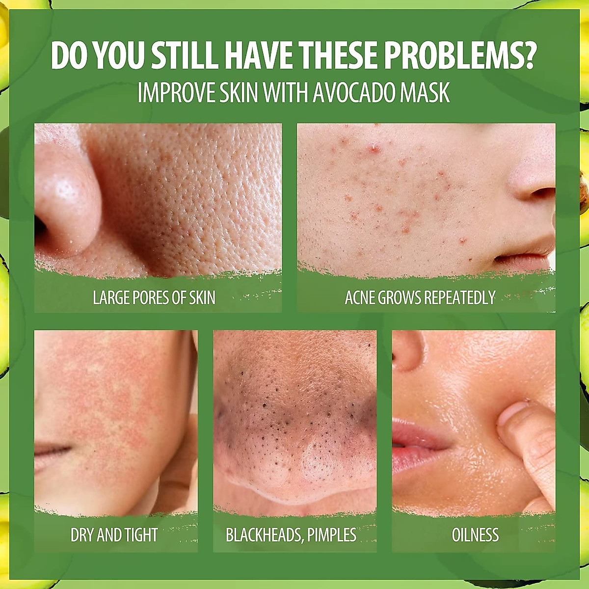 Clay Stick Mask Avocado Dead sea Mud Mask Natural Green Tea Purifying Clay Stick Mask Deep Cleansing Blackhead Remover Clay Mask Nourishing Hydration Facial Mask With Blackhead Remover Extractor Tools