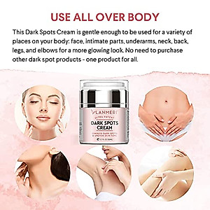 Lanmeri Dark Spot Remover for Face and Body, Dark Spot Corrector Fade Cream, Age Spot, Brown Spot, Sun Spot & Freckle Remover for Face, Hands and Other Body Areas, for Both Women and Men, for All Skin Types