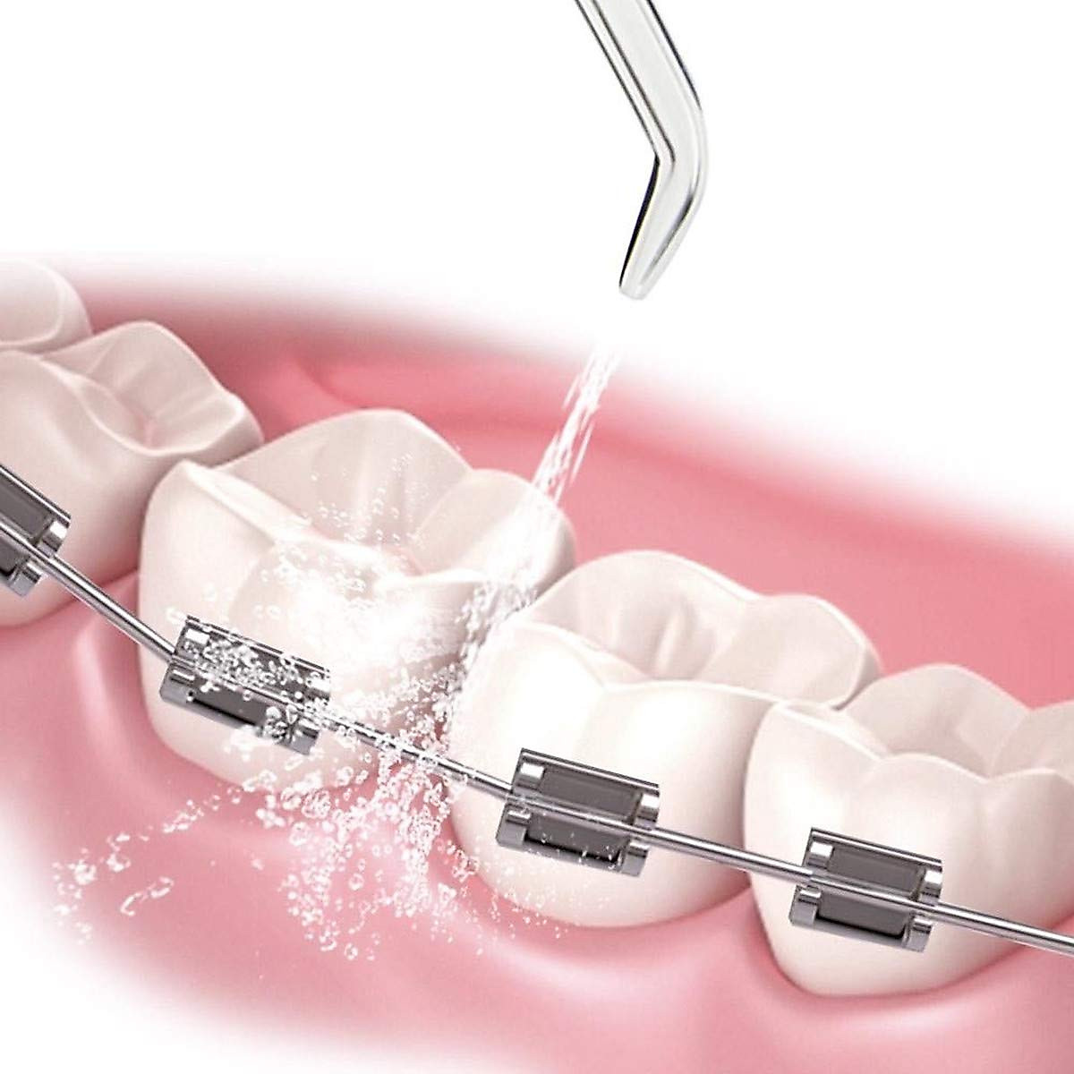 Flosser Replacement Tips for Waterpik Water Flosser, High-Pressure Jet Tips, Flosser Refill Replacement Heads, Compatible with Waterpik Oral Irrigator and Dental Flossers, Orthodontic Tips 4 Packs