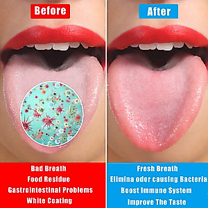Stainless Steel Tongue Scraper Cleaner, 2 Pack Fresh Breath Tongue Cleaner for Adults, Kids, Men and Women, Surgical Grade Metal Scraper for Healty Oral Care, Bad Breath Cure (with 2 Travel Cases)