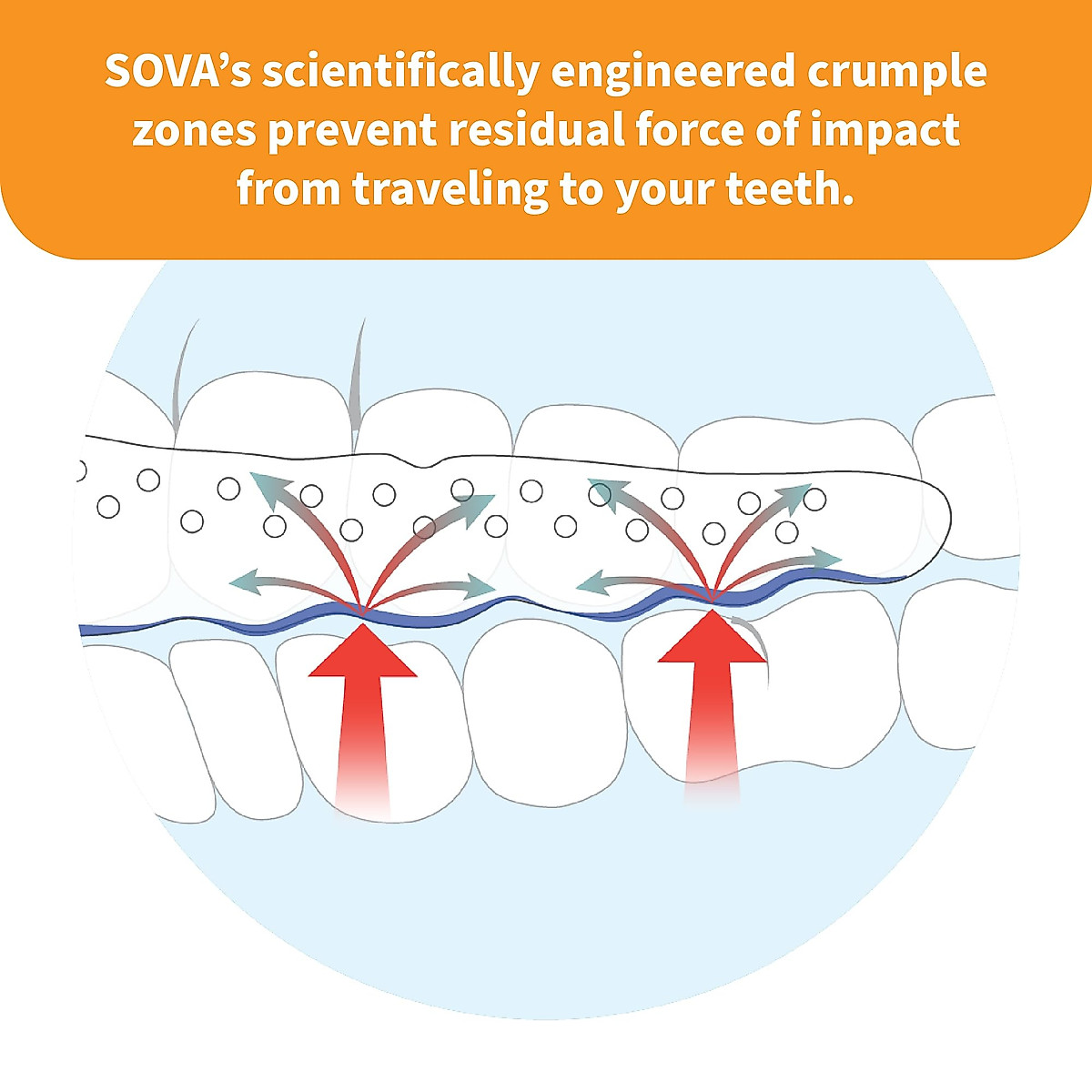 SOVA Junior Night Guard, Purple Punch - 1.6mm Thin - Custom-Molded Fit - Protects Against Nighttime Teeth Grinding & Clenching - FSA/HSA Eligible - Odor & Taste Free - Remoldable Up to 20 Times