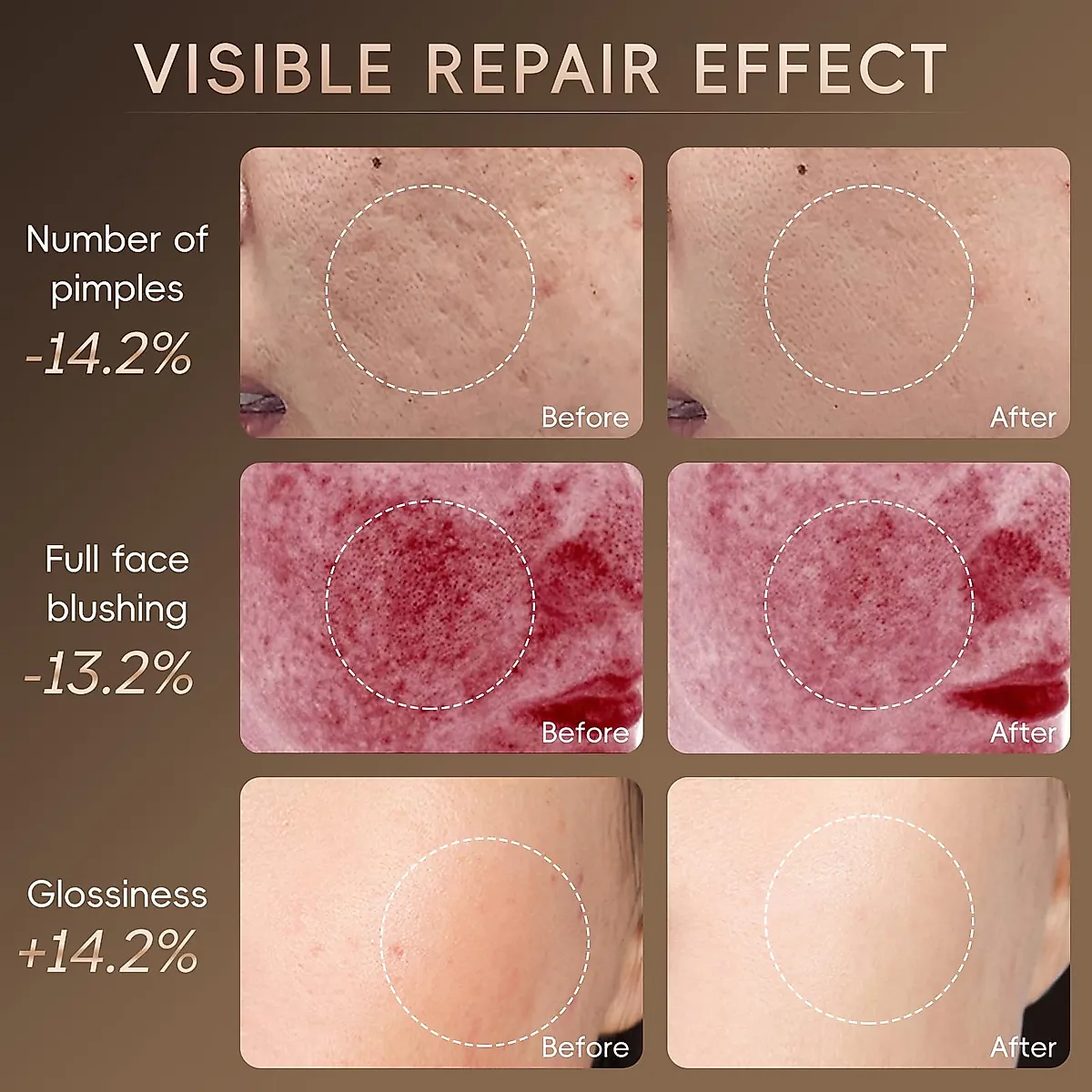 Red Light Therapy For Face - Hendoct LED Face Mask Light Therapy, Red Light Therapy Mask, Blue & Red Light Therapy Mask for Facial Skin Care