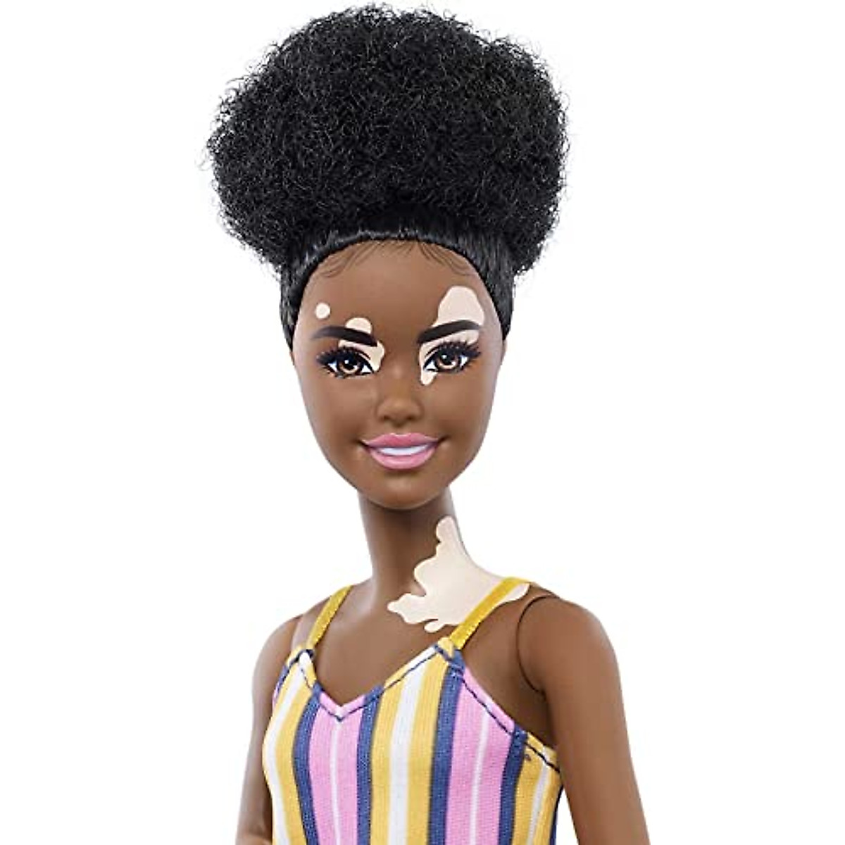 Barbie Fashionistas Doll #135 with Natural Curly Hair and Vitiligo Wearing Striped Dress and Accessories