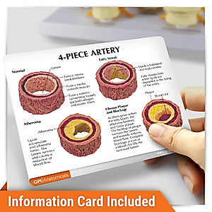 4-Piece Artery Model | Human Body Anatomy Replica of Artery w/Plaque Build Up for Doctors Office Educational Tool | GPI Anatomicals
