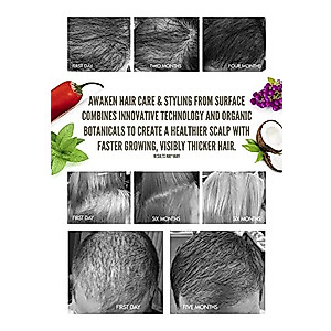 Surface Hair Awaken Therapeutic Conditioner, Healthy Hair Conditioner with Protein, Thickening Conditioner, Treatment for Thinning Hair and Hair Loss