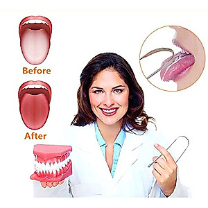 YIBIDINAY Tongue Scraper Cleaner for Adults Surgical Grade Stainless Steel Metal Tongue Brush Dental Kit Professional Eliminate Bad Breath With Non-synthetic Grip (2 Pack)