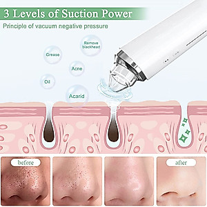 Blackhead Remover Pore Vacuum, 【[FDA Certification] 】WiFi Visible Facial Pore Cleanser with HD Camera Pimple Acne Comedone Extractor Kit with 6 Suction Heads Electric Blackhead Suction Tool