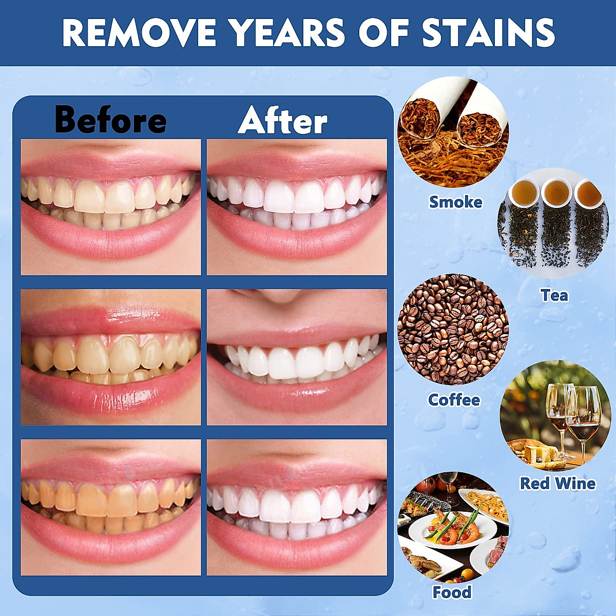 Teeth Whitening Kit (White)