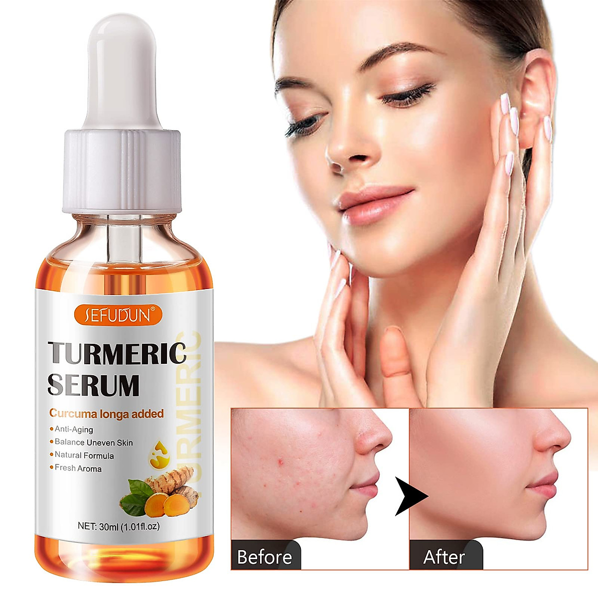 2 Pack Turmeric Serum for Dark Spots, Turmeric Dark Spot Corrector Serum for Acne, Hyperpigmentation and Smooth Skin, Formulated with Hyaluronic Acid, Vitamin C & E - 1.01 FL.OZ