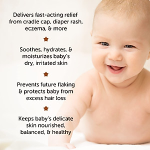 Organic Calendula Ointment Baby Rash Cream - Baby Eczema Cream, Cradle Cap Treatment, Diaper Rash Ointment, Baby Butt Cream - Calendula Oil, Manuka Honey, Lavender, and Coconut - Baby Skin Care (2oz)