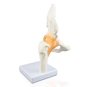 Vision Scientific VAJ233 Classic Functional Hip Joint Model, Articulates with Life-Like Flexible Ligaments, Features Femur, Hip Bone & Surrounding Ligaments