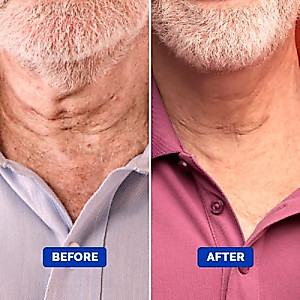 Particle Neck Cream for Men - Neck Firming Cream, Lift and Moisturize The Neck | Use on Saggy Skin or Turkey Neck | Anti Aging Triple Action Neck Cream with Collagen, Hyaluronic Acid, Retinol (50 ml)